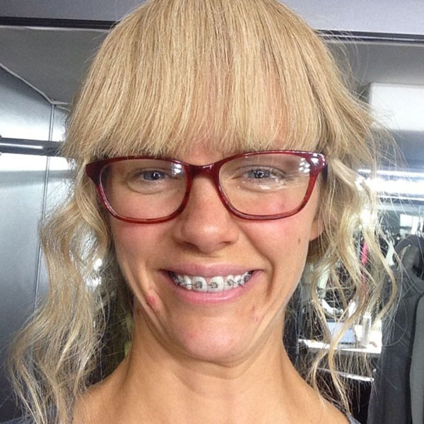 See Brooklyn Decker With Pimples Braces And Nerd Glasses E Online