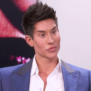 Human Ken Doll Risks Blindness to Have Veins in Forehead Removed - E ...