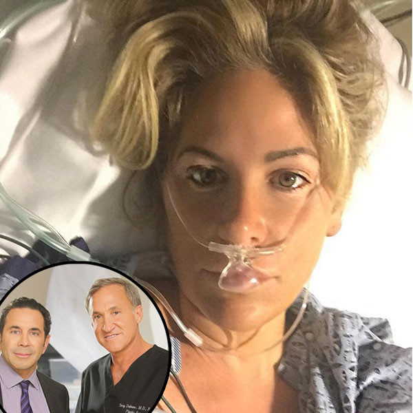 Botched Drs. Talk Kim Zolciak's Mini Stroke: Watch!