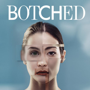 Botched Renewed for Season 4: Get the Details! - E! Online