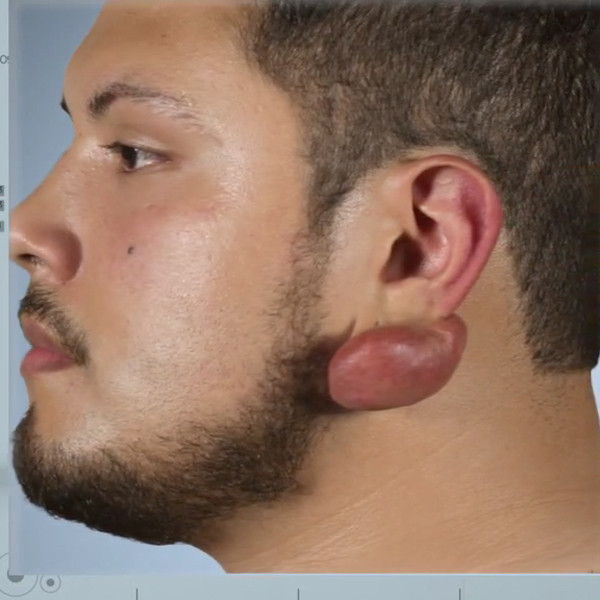 Botched Drs. Give Patient a ''New Life'' on Shocking Episode - E! Online