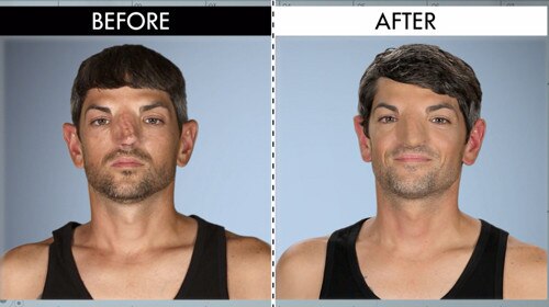 Botched Surgery Pictures Before And After