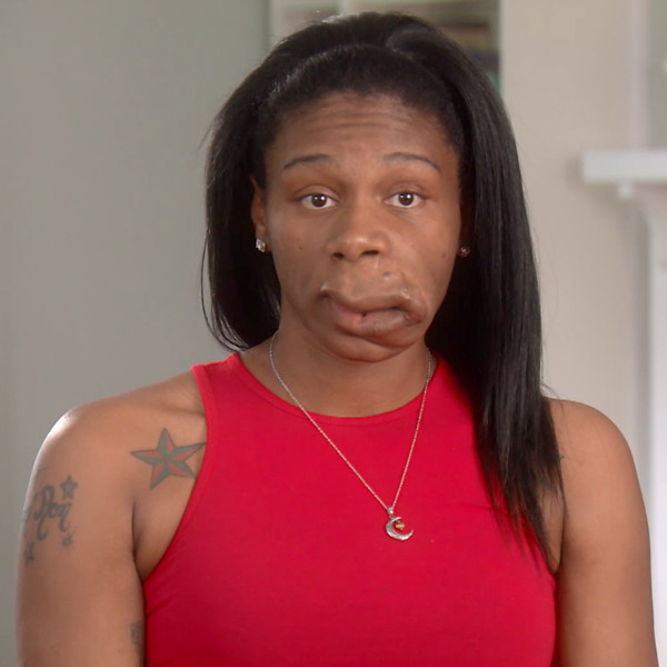 Drs. Help Reconstruct Woman's Face on Botched By Nature: Watch! | E! News