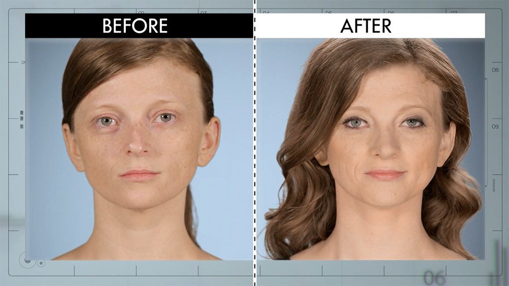 Photos from Botched Patients Before and After: Shocking Transformations ...