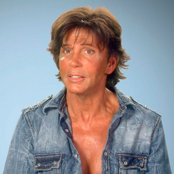 This Patient's Triceps Were Seriously Botched By a Doctor