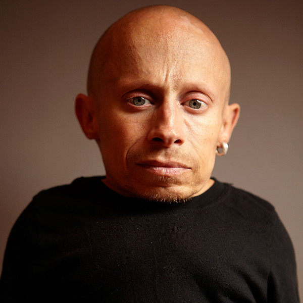 Verne Troyer's Cause of Death Ruled as Suicide | E! News