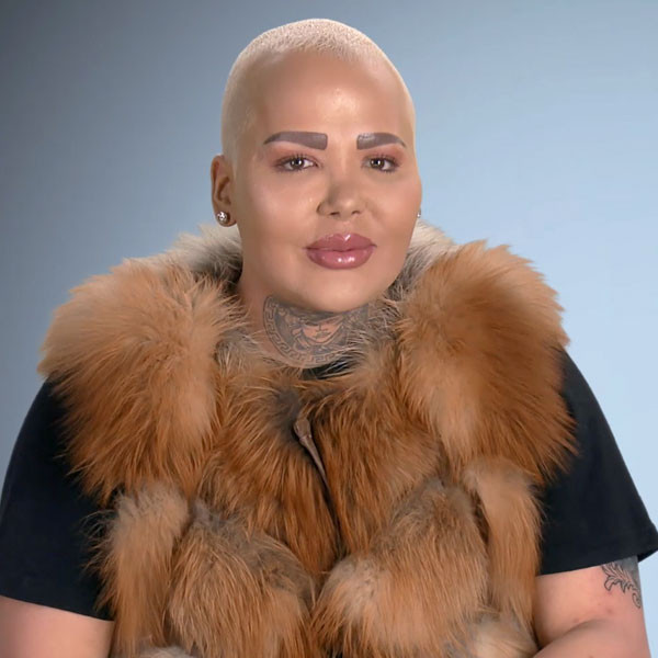 Photos from Most Interesting Patients on Botched - E! Online