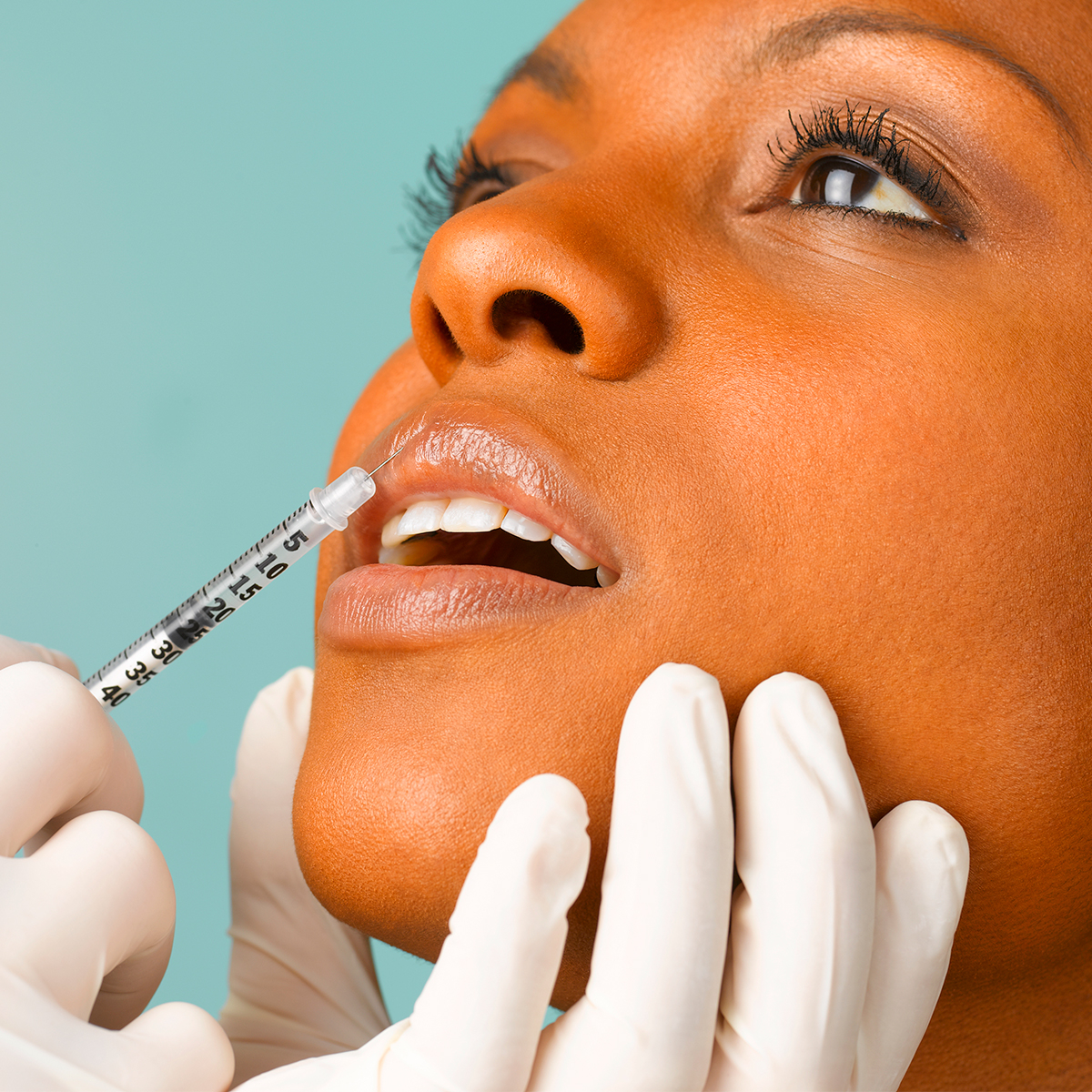 Everything to Know About How Celebrities Are Dissolving Facial Fillers